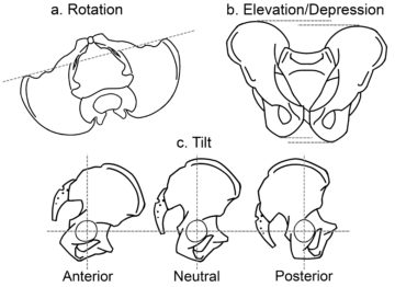 Considerations for Leg Length Discrepancies