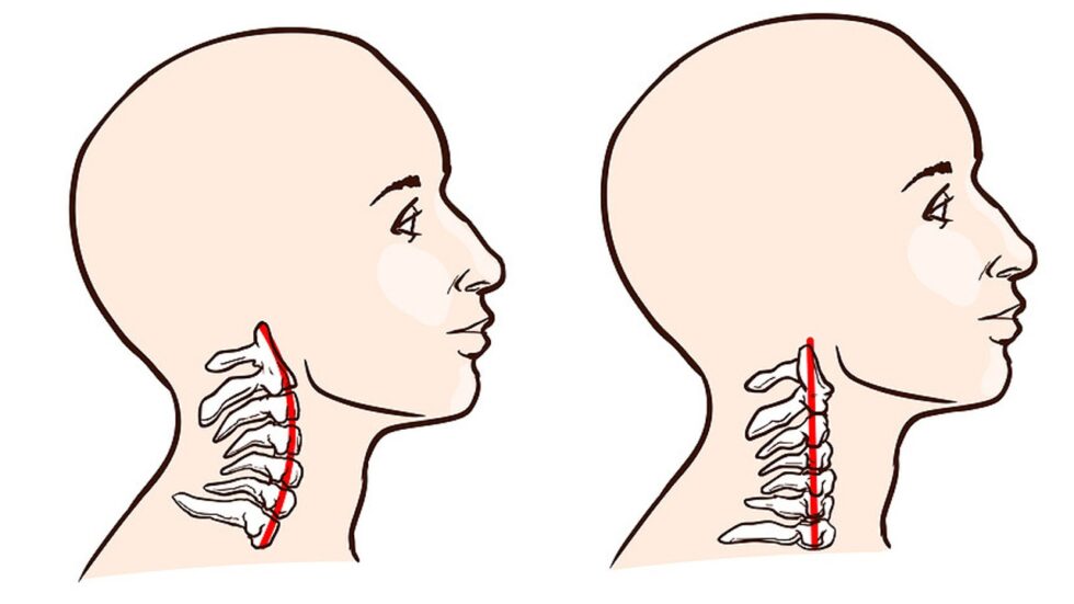 Neck Pain and Posture - Jessica Kisiel Wellness Blog